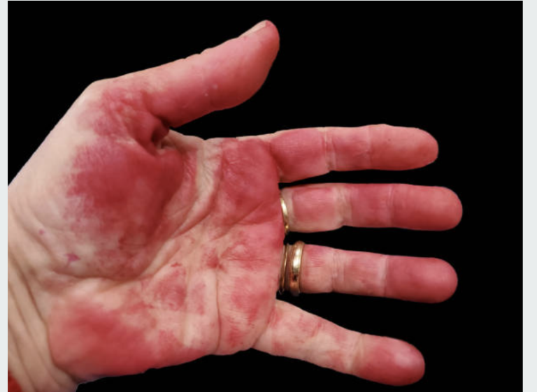 Zero Waste Beetroot Lip Stain Recipe - Zero Waste Memoirs